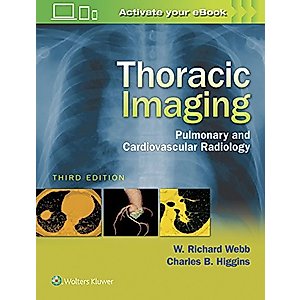 Thoracic Imaging: Pulmonary and Cardiovascular Radiology