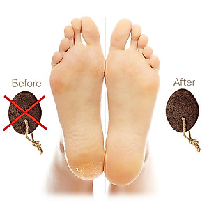 Pumice Stones for Feet - Natural Earth Lava Brown Pack of 2 - Callus Corn Remover for Feet Heels and Palm - Pedicure Exfoliation Tool - Dry Dead Skin Scrubber - Health Foot Care