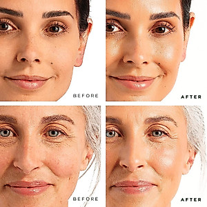 Tree of Life Facial Skin Care Set, Brightening, Firming, Hydrating, Dry Face, Dermatologist Tested - Vitamin C Serum (Brightens) + Retinol Serum (Smooths) - Skin Care Kit, 2 count of 1 Fl Oz