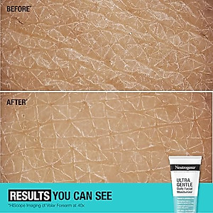 Neutrogena Fragrance Free Daily Facial Moisturizer, Face Moisturizer for Sensitive & Dry Skin with Vitamin B3, Pro-Vitamin B5 & Vitamin E, Supports Skin's Dynamic Barrier, 3.4 fl. oz