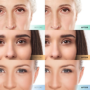 Cosmedica Skincare Facial Serum Trio Set Value for Clear Skin - Vitamin C Super Serum, 2.5% Retinol Serum, Pure Hyaluronic Acid Serum – Vegan, Cruelty-Free Skincare 3 pack