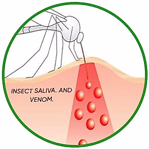 Bug Bite Remover Get Itch Relief from Mosquito Bites with This Suction Tool. This is Similar to The Bug bite Thing seen on Shark Tank, Except Ours is Better with a Battery Powered Suction Pump.