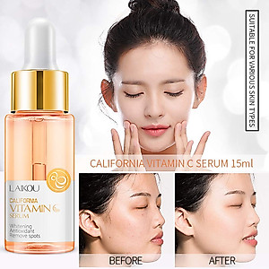 AKARY Vitamin C Serum with Hyaluronic Acid Organic Firm Skin Reduce Formula for Face Skin Improve Remove Flaw Essence