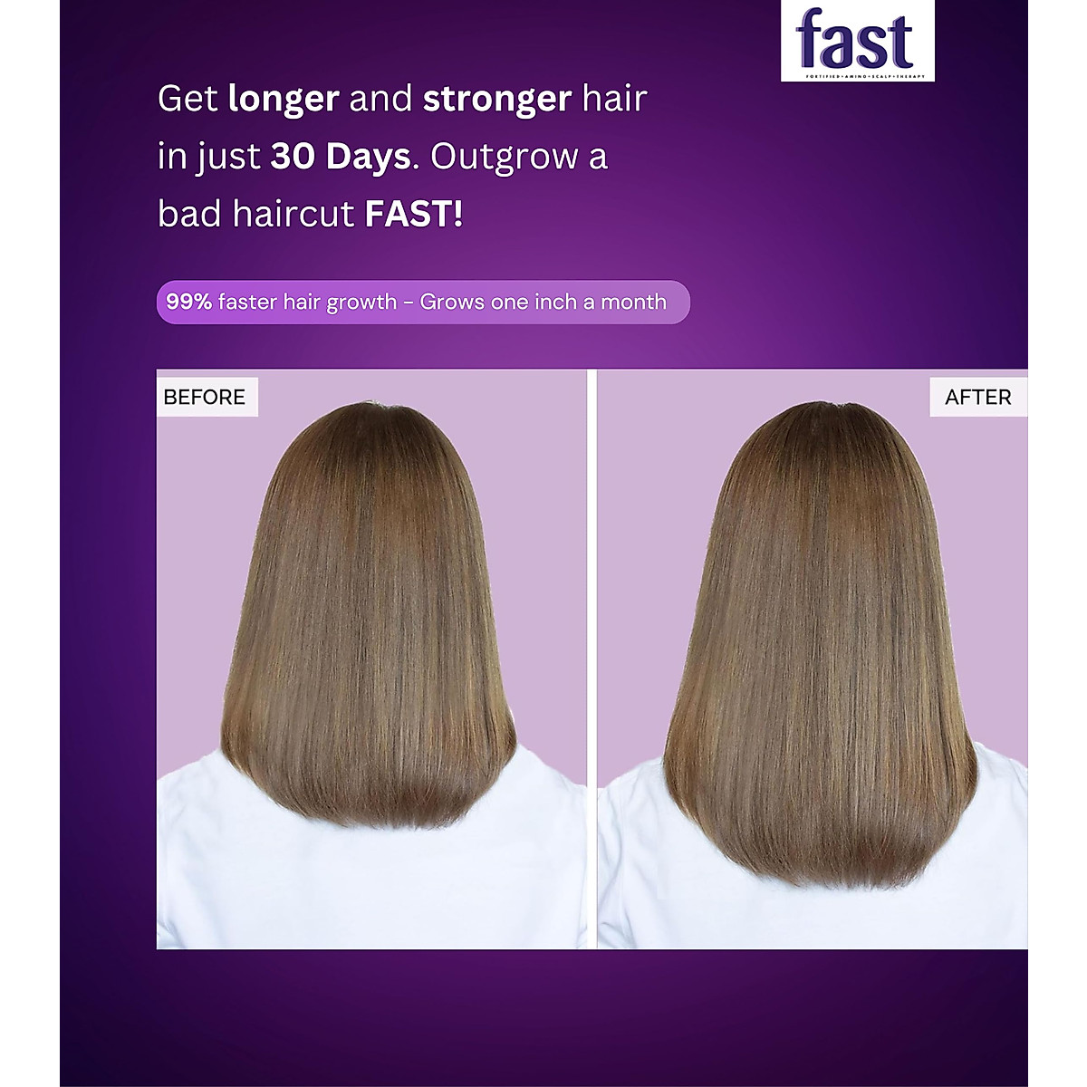 Nisim F.A.S.T. Fortified Amino Scalp Therapy Shampoo, 10 fl oz - Supports Faster Hair Growth with Essential Nutrients, Amino Acids & Proteins - Sulfate, Paraben-free