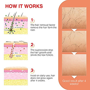 LOVOOD Hair Growth Inhibitor Spray - Non-Irritating & Painless for Face & Body, 1.01 Fl Oz (Pack of 1)