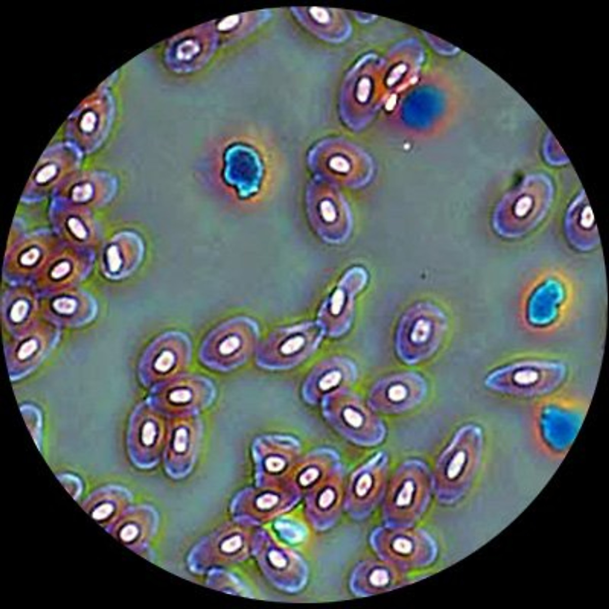 AmScope T690B-PCT200-PL Phase-Contrast Trinocular Compound Microscope, 40X-2000X Magnification, WH10x and WH20x Super-Widefield Eyepieces, Infinity Plan Achromatic Objectives, Brightfield, Kohler Condenser, Double-Layer Mechanical Stage, Includes 4 Phase