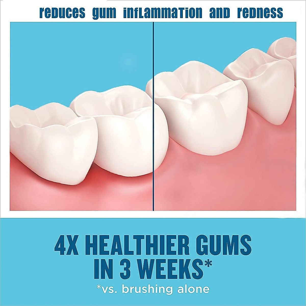 3PCs Teeth Whitening Mouthwash, Calculus Removal, Healing Mouth Ulcers, Eliminating Bad Breath, Prevents and Treats Cavities,Tooth Regeneration(50ml)