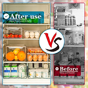 Pomeat 7 Pack Fridge Organizers, Stackable Refrigerator Organizer Bins with Lids, Plastic Storage Bins, BPA-Free Fridge Organizers and Storage Clear for Food, Drinks, Fruits, Vegetable Storage