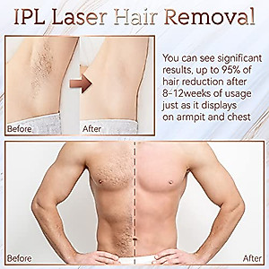 Aopvui At-Home IPL Hair Removal for Women and Men, Permanent Laser Hair Removal 999900 Flashes for Facial Legs Arms Whole Body Treatment