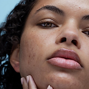 Obagi CLENZIderm M.D. Therapeutic Lotion – Lightweight Acne Treatment with 5% Benzoyl Peroxide (BPO) – 1.6 oz