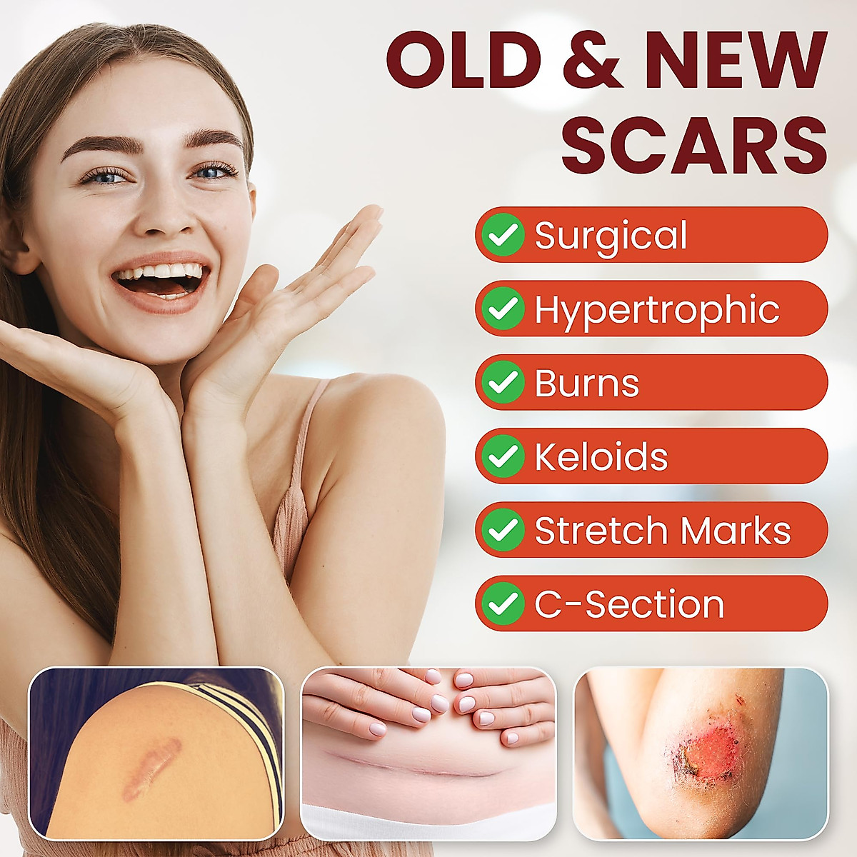 e70 Intensive Healing Scar Cream - Fast Repair Surgical Scars, C-Section, Stretch Marks, Keloids, Burns, Old & New Scars. Vitamins Full - All Skin Types - Reduce Acne Spots Appearance - 2.0 Fl Oz