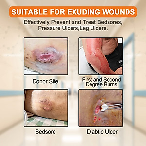 Carbou Silicone Sacrum Foam Dressing, 9''x9''(23cm x23cm) Bordered Silicone Adhesive Sacral Foam Dressing,Silicone Wound Care Products,Box of 5 Dressings