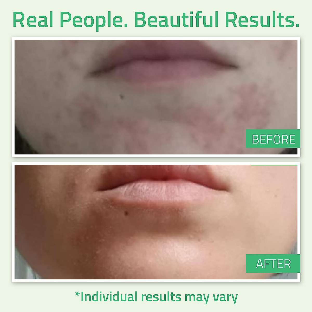 YEOUTH Glycolic Acid Peel for Face, At Home Exfoliator Aha 30% Glycolic Acid Face Peel with Retinol, Designed to Refresh & Smooth the Appearance of Skin 1oz