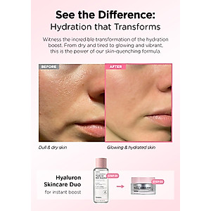 Hanskin Real Complexion Hyaluronic Skin Essence, Hydrating Toner for Dry, Dull, Sensitive Skin - Hyaluronic Acid Collagen Moisturizing Purifying Paraben-Free Korean Skincare for Face [5.07 fl. oz.]