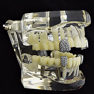 Single Cap Tooth Set CZ Cubic Zirconia Silver Tone 2 Top Teeth Plus Two Bottom Iced Canine Cap Grills