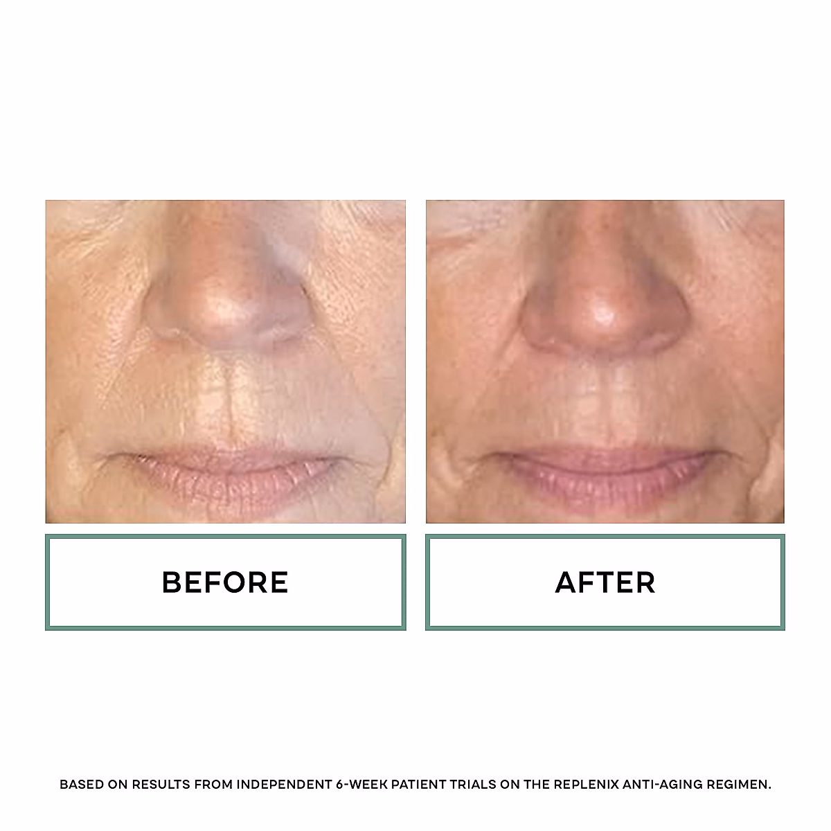 Replenix Hydrating Antioxidant Tinted Mineral Sunscreen with Medical-Grade Zinc, Dermatologist-Developed Oil-Free SPF 50+ for Face & Body (4 fl. oz.)