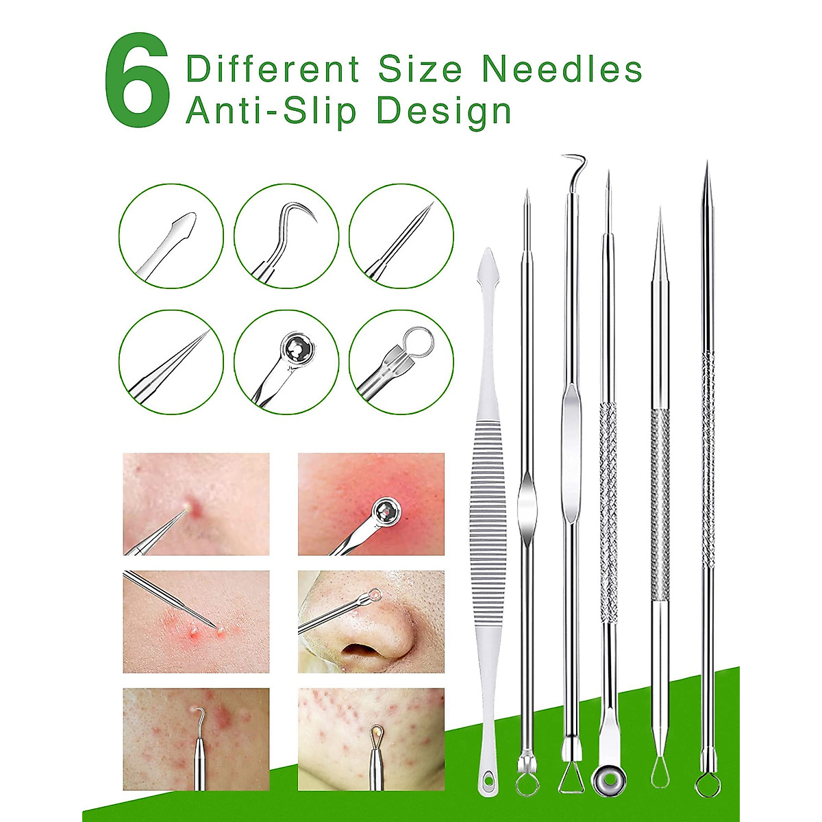 15 PCS Blackhead Remover Pimple Popper Tool Kit,Black Head Removal Extractor for Acne Comedone Whitehead Popping Zit Blemish Facial Skin Care Tools with Metal Case