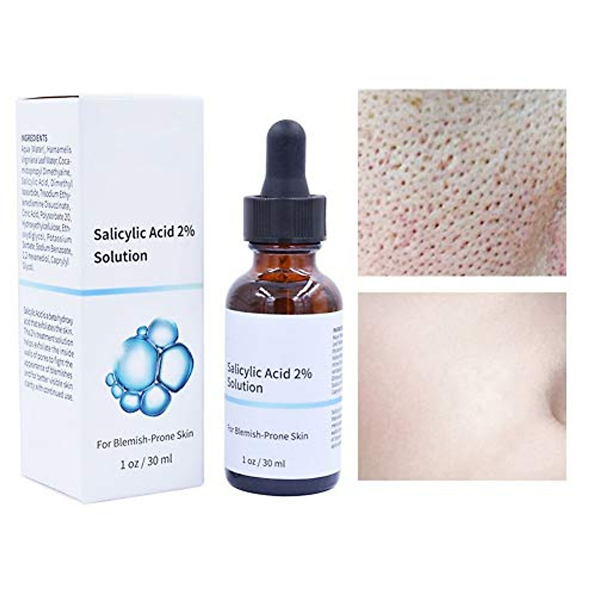 Luxsea Salicylic Acid 2% Solution Face Serum Shrink Pores Hyaluronic Acid Serum Gentle Exfoliating for Smoother & Clearer Skin, Treats Rosacea, Blackheads, Clogged Pores, Dullness, Oily Acne Skin