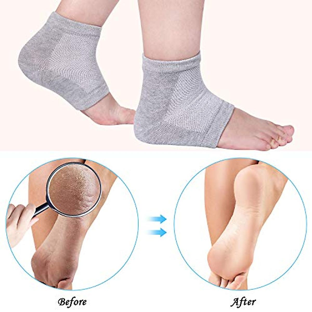 Bememo Soft Gel Heel Socks Ventilate Open Toe Socks 4 Pairs for Dry Hard Cracked Skin Moisturizing Day Night Care Skin (Gray)