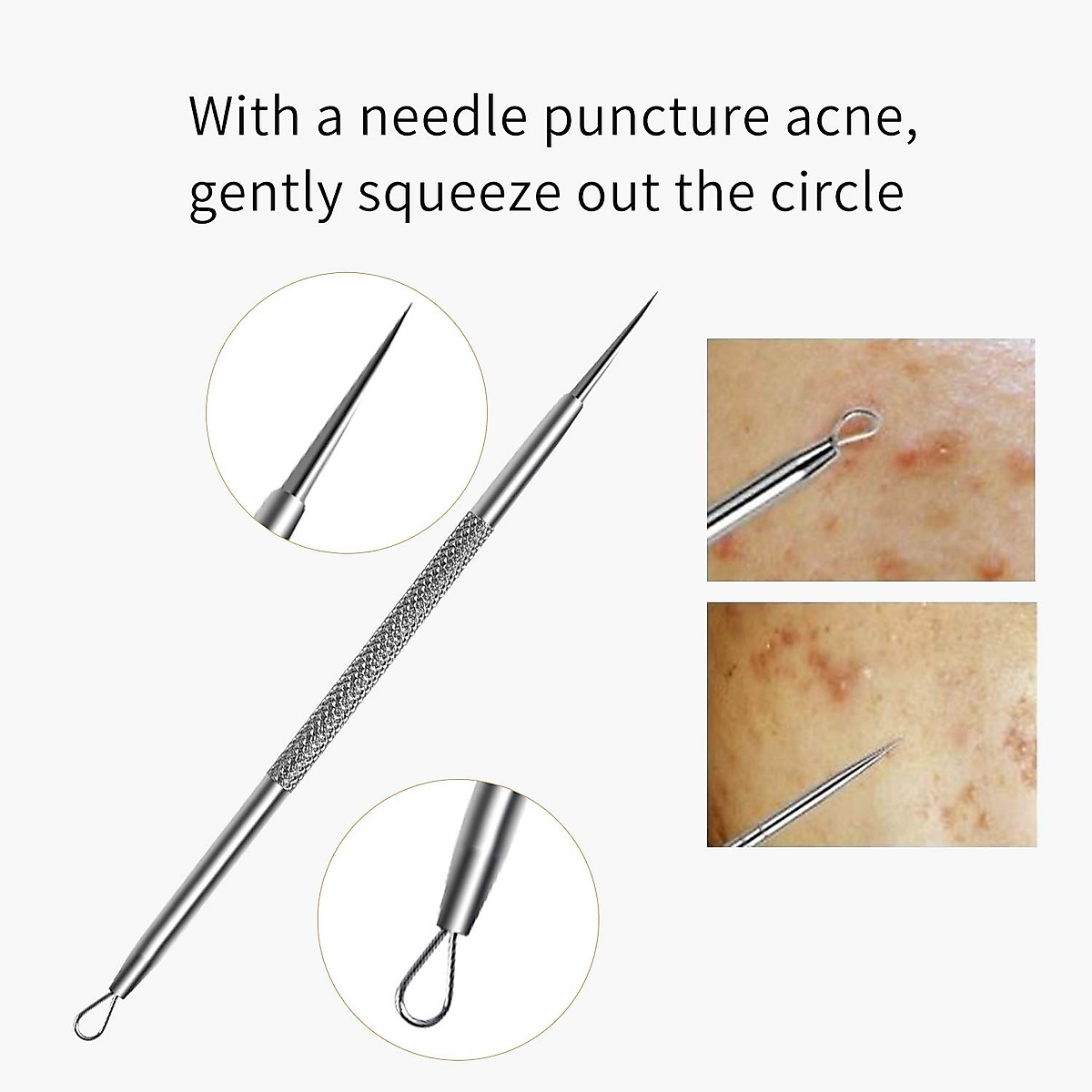 FIXBODY Blackhead and Splinter Remover Tools - Stainless Steel Professional Easily Cure Pimples Whiteheads Comedones Acne Zit Ingrown Hairs and Facial Impurities Bend Head Tweezer Surgical Kit