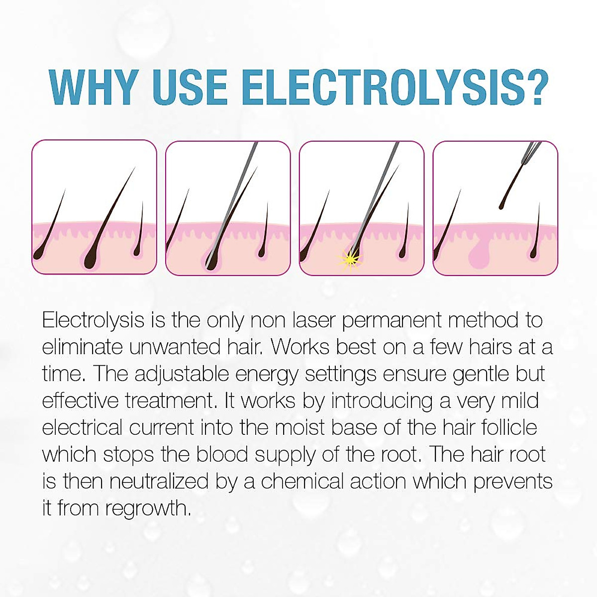 Clean + Easy Non-Laser Personal Electrolysis Device - Permanent Hair Removal for Face and Body, Battery Operated, Painless and Convenient Home Treatment