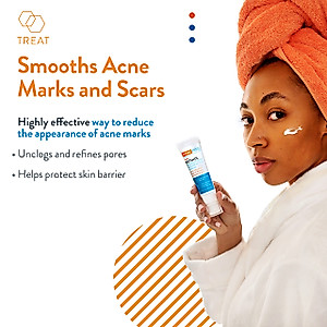 AcneFree Retinol Blemish Mark Resurfacing Serum with Hyaluronic Acid, and Niacinamide | Helps to Reduce the Appearance of Acne Marks | Redness Control | 1 Ounce