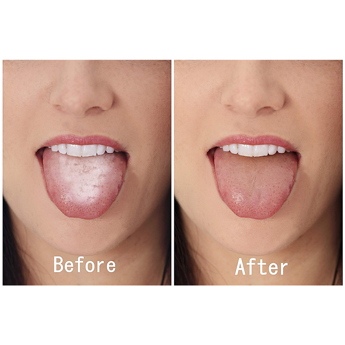 TE to TE KT-31 Pure Titanium Japanese Tongue Cleaner, Moss & Premium II, Matte Peach, Total Length 5.9 inches (150 mm) (Matte Champagne)