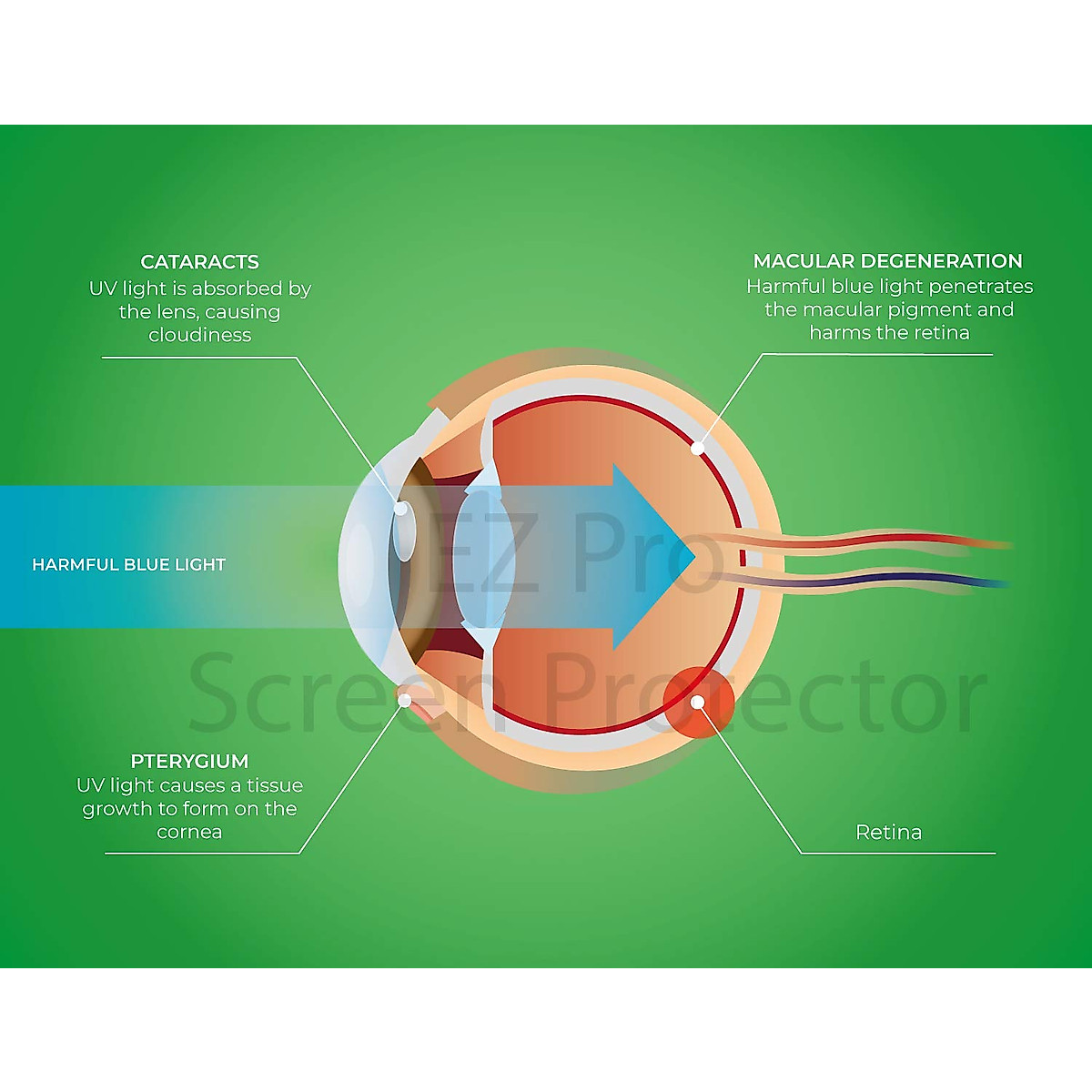 Premium Anti Blue Light and Anti Glare Screen Protector (3 Pack) for 15.6 Inches Laptop. Filter out Blue Light and relieve computer eye strain to help you sleep better