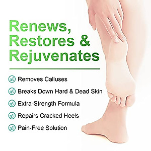 Feet Callus Remover Gel, 12 Packs 8.4 oz with Pumice Stone Scrubber Kit for Professional Pedicure Remove Hard Skins Heels Callouses, Jasmine Scent