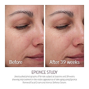 Epionce Renewal Facial Cream - Hydrating, Anti-Aging Moisturizer for Dry & Sensitive to Normal Skin, For Fine Lines & Wrinkles, Dermatologist Skincare
