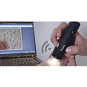 Firefly DE350 Wireless Polarizing Dermatoscope