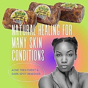 Infinix Beauty 3PCS 1LB 100% Natural African Black Soap with Shea Butter and Pure Honey for Dark Spot Smoother