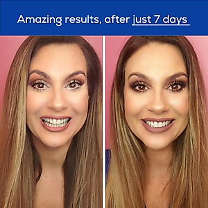 GLO Science Brilliant Teeth Whitening Gel Treatment Refill Vials, Mint Flavored, Clinically Proven to be Sensitivity & Pain-Free and Give Long Lasting Results | 3 Count (12 applications)