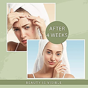 OSITO LED Light Therapy Facial Mask (FSA/HSA Eligible) Acne Treatment LED Mask Facial Therapy Red Light Reduces Wrinkles Unlimited Sessions for Acne Face Skin Treatment