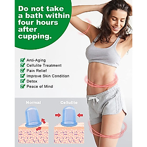 Silicone Cupping Therapy Sets, Anti Cellulite Cup Massager - Vacuum Suction Cup for Cellulite Treatment - Amazing Cellulite Remover