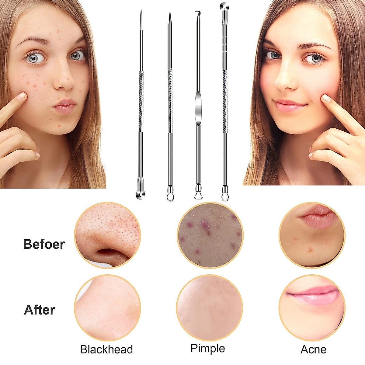 Blackhead Removal Tools, 4 Pcs Pimple Popper Tool Kit, Professional Stainless Pimples Comedone Extractor with Portable Case(Silver)