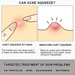 Pointed Blackhead Removal, 2-in-1 Acne Extractor Tool - Stainless Steel Whitehead Remover for Face/Nose