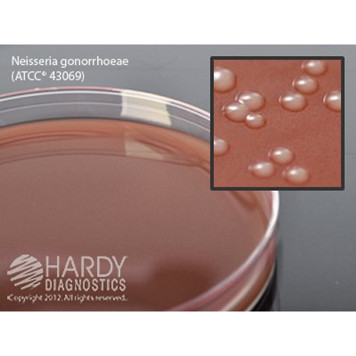 Chocolate Agar, (GC Agar Base with 1 Percent Bovine Hemoglobin and Koenzyme Supplements), for Fastidious Bacteria, 15x100mm Plate, Order by The Package of 10 Plates, by Hardy Diagnostics