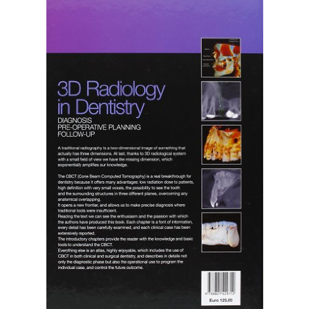 3D radiology in dentistry - Diagnosis Pre-operative Planning Follow-up