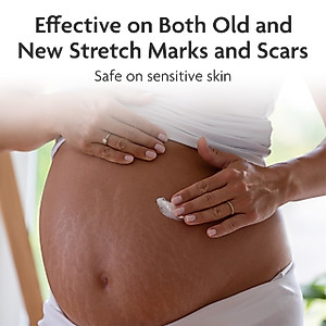 TriLASTIN SR Vit. Infused Intensive Stretch Mark & Scar Cream for Pregnancy - 5.5 Oz, Cocoa Butter Scar Treatment, Hypoallergenic & Paraben-Free - Moisturizing Lotion for Women