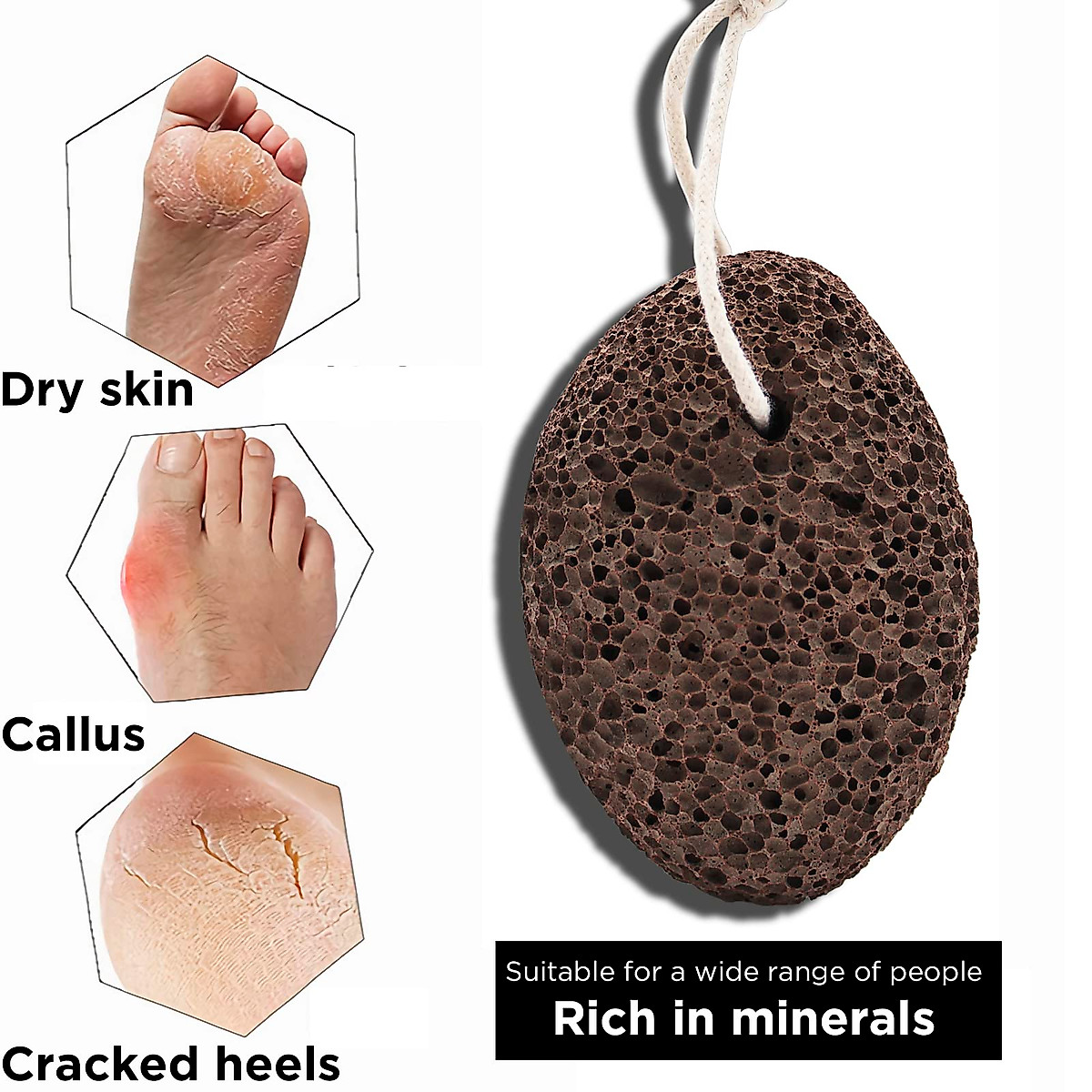 ICANdOIT Natural Brown Earth Lava Pumice Stone, Pedicure Exfoliation Tool,Callus Remover for Feet Heels and Palm,Corn Remover,Dry Dead Skin Scrubber,Health Foot Care,Dry&Wet Use,Pack of 1