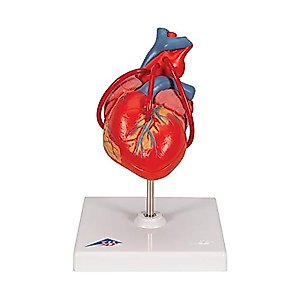 3B Scientific G05 Classic Heart w/ Bypass 2-part - 3B Smart Anatomy