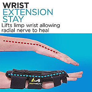 BraceAbility Radial Nerve Palsy Splint - Dynamic Wrist Drop and Limp Finger Extension Brace for Saturday Night, Honeymoon, and Crutch Palsy Treatment (One Size)