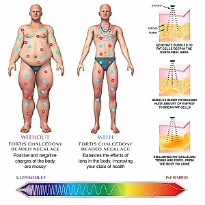 lunhaifi Fortis Marvik Chalcedony Beaded Necklace, Fortis Chalcedony Beaded Necklace, Natural Tiger Eye Beads Beaded Necklace Chain for Men/Women Effective Body Detoxification (2Pcs)