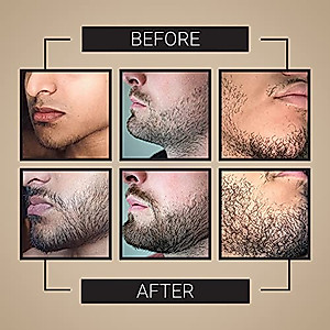 Beard Growth Pills | Beard Growth Vitamins | Beard Growth Supplement | Biotin & Collagen | Beard Pills | Beard Vitamins for All Hair Types | Beard Growth Biotin (1 Pack)