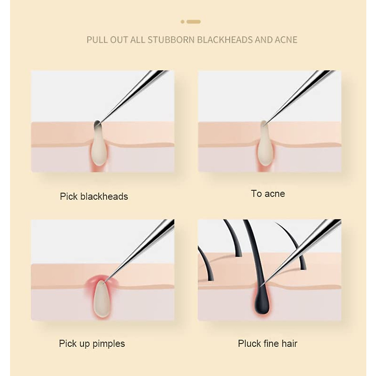 ericotry 1Pcs Stainless Steel Pointed Tweezers Ingrown Hair Tweezer Blackhead Remover Splinter Tweezer