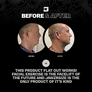 Jawzrsize Jaw, Face, and Neck Exerciser - Define Your Jawline, Slim and Tone Your Face, Look Younger and Healthier - Helps Reduce Stress and Cravings - Facial Exerciser (Level 4 - Elite) (Green)