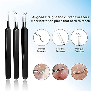 Pimple Popper Tool Kit 11 Pcs, Ybaoo Blackhead Remover Pimple Extractor Tools with Metal Case for Quick and Easy Removal of Blackheads,Pimples,Whiteheads,Zit Popper,Forehead,Facial and Nose (Black)