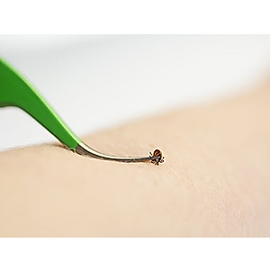 TickCheck Premium Tick Remover Kit - Stainless Steel Tick Remover + Tweezers, Leather Case, and Free Pocket Tick Identification Card (1 Set)