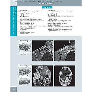 Diagnostic Imaging: Spine